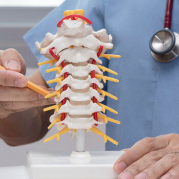 After Chiari Malformation Surgery: What to Expect