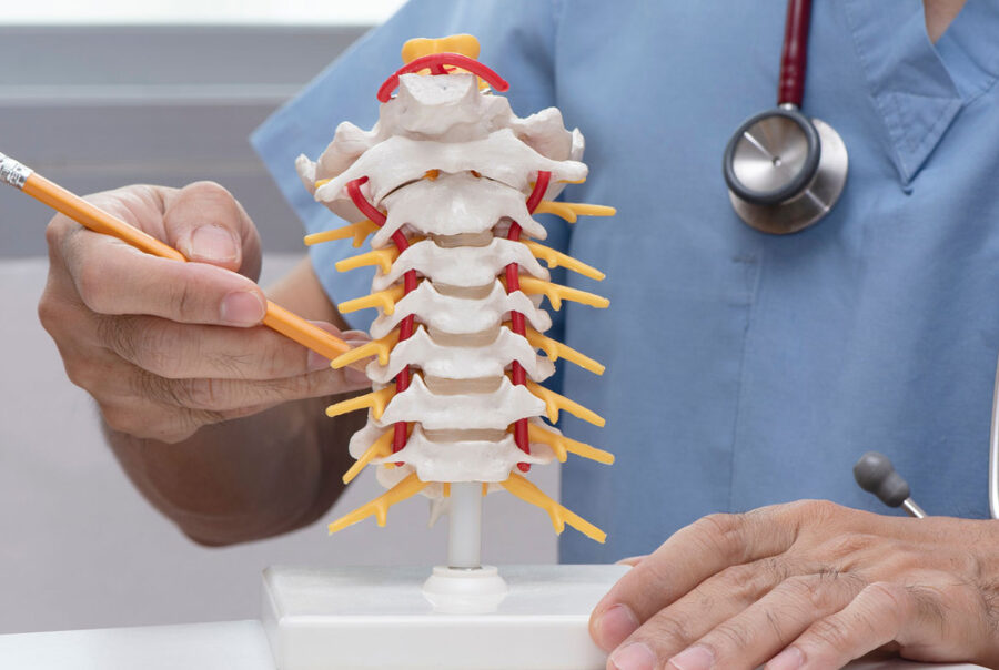 Cervical Foraminal Stenosis – Causes, Symptoms, and Treatment