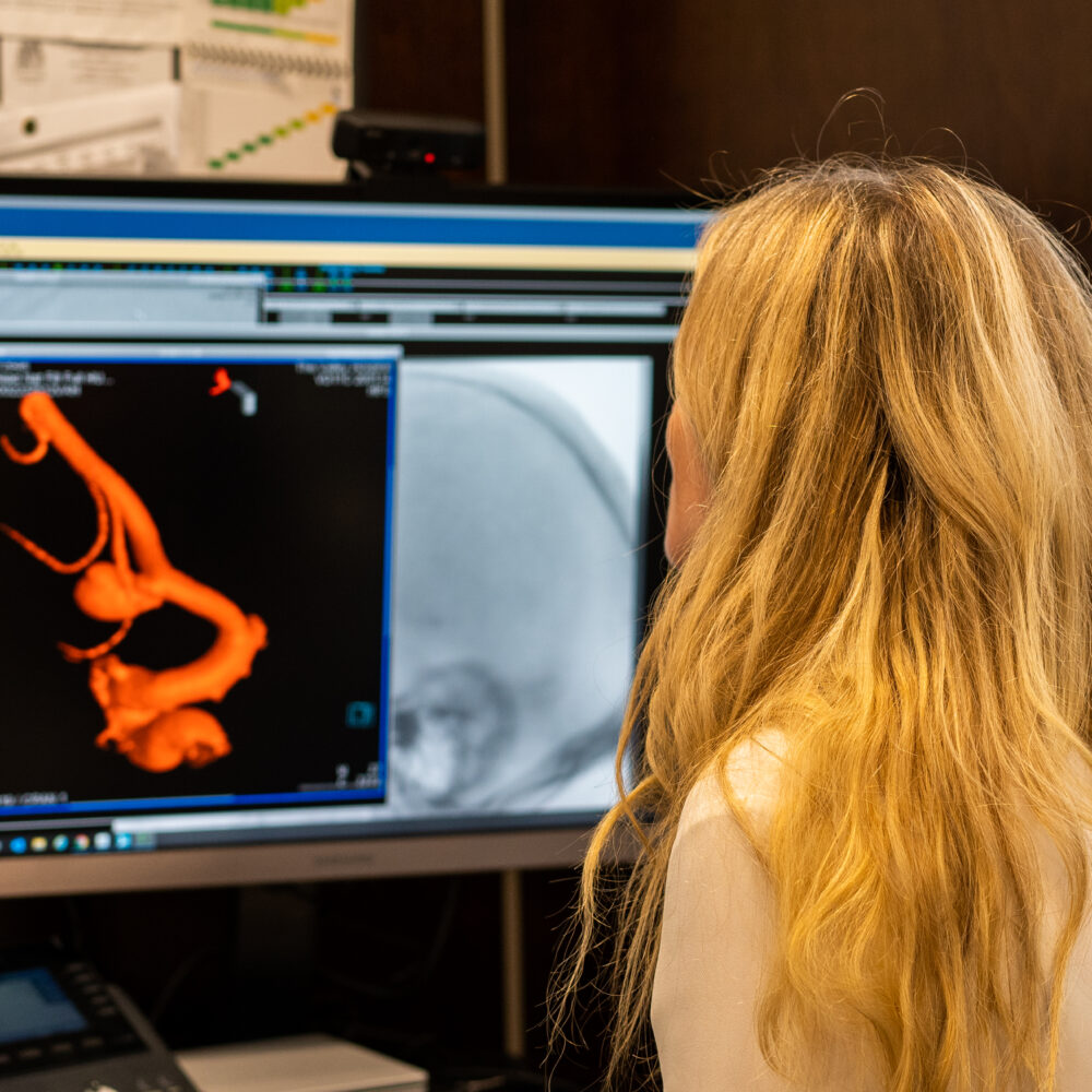 After Chiari Malformation Surgery: What to Expect