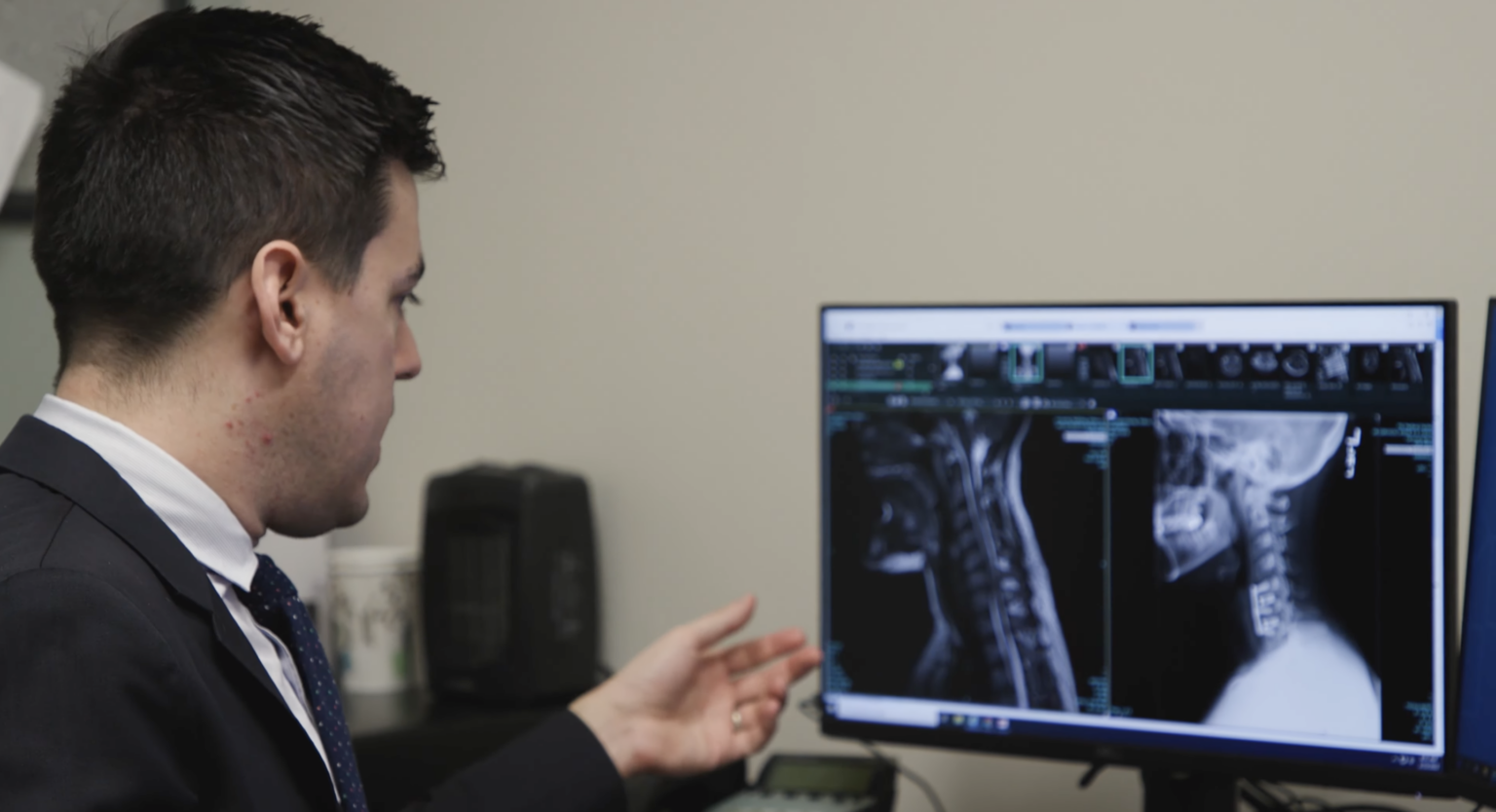 Anthony Conte | Top Rated Spine Surgeon