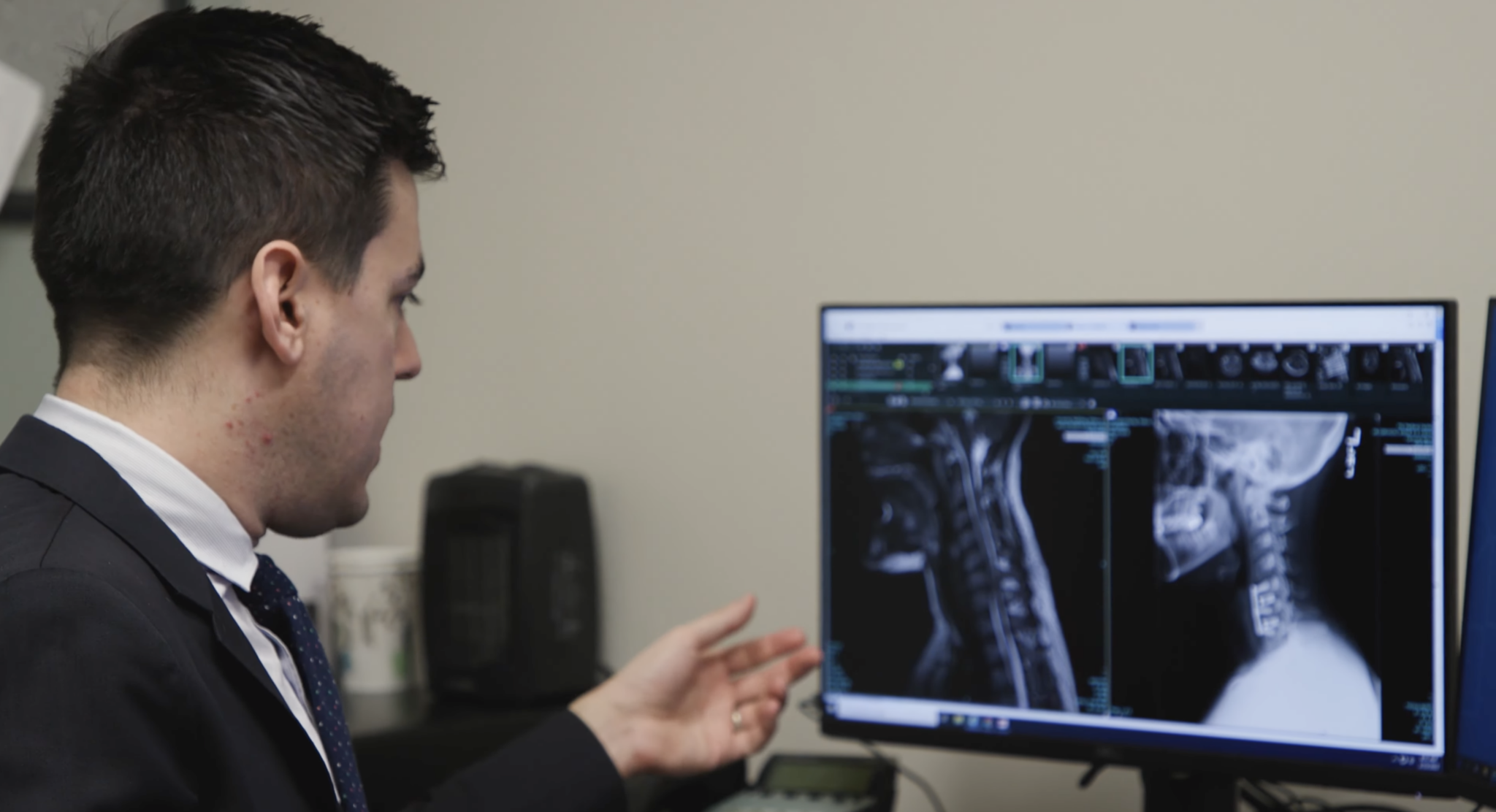 Anthony Conte | Top Rated Spine Surgeon