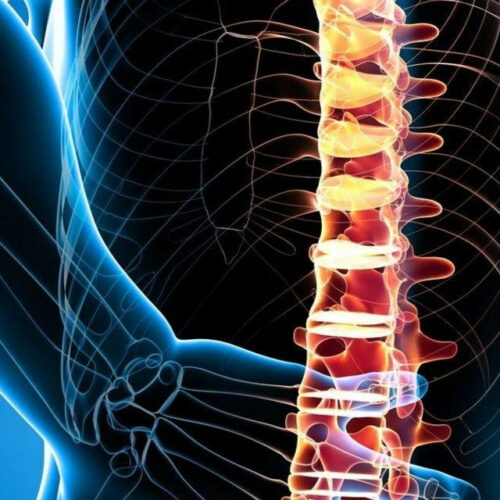Naomi’s Story Before and After Selective Dorsal Rhizotomy