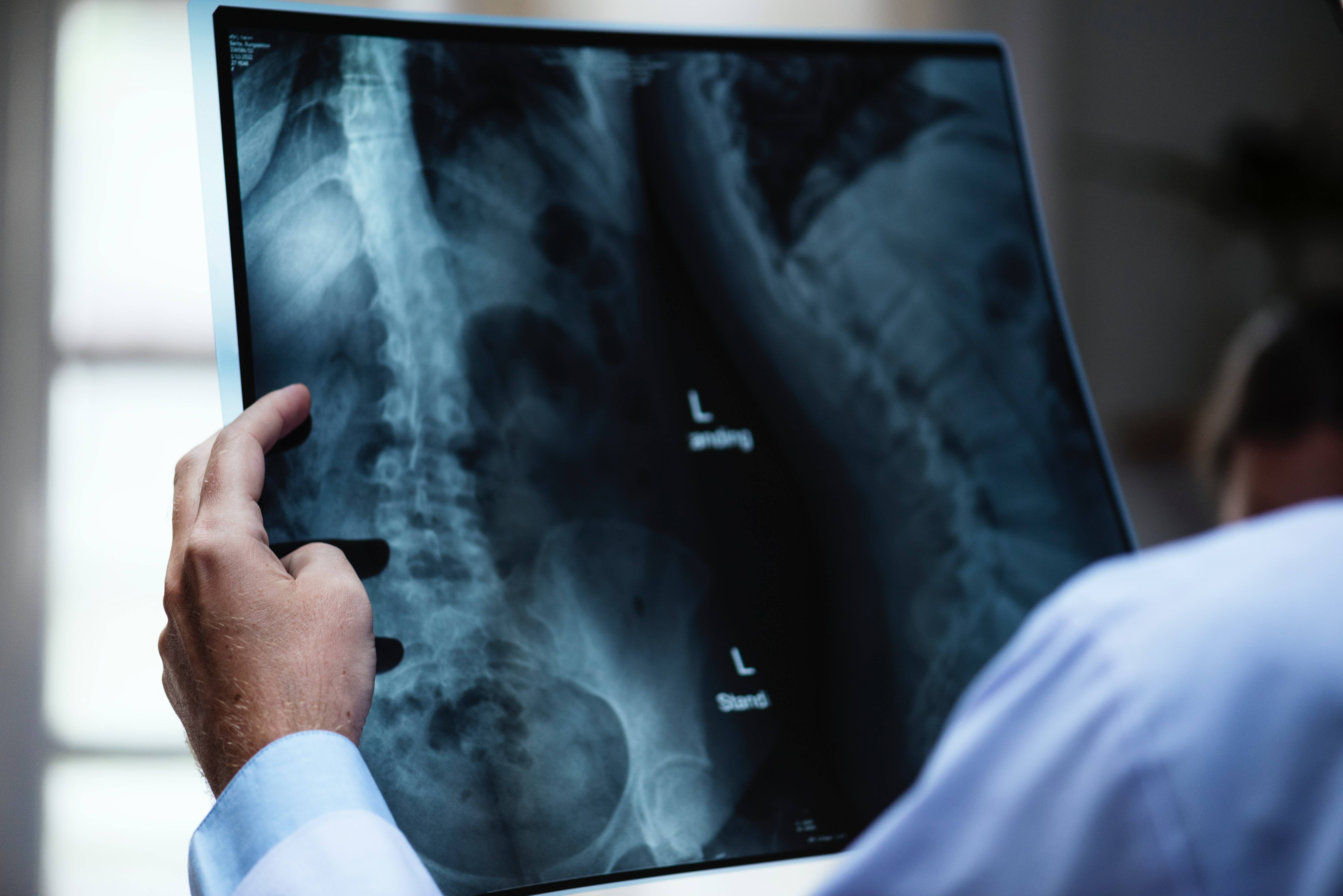 Minimally Invasive Spine Surgeons - Neurosurgeons of New Jersey