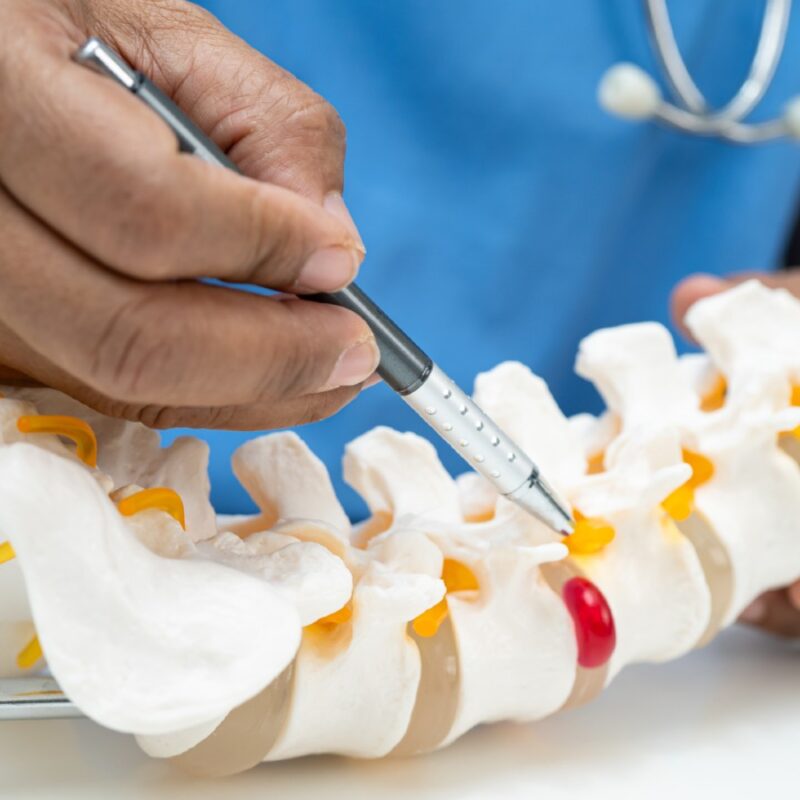 Endoscopic Spine Surgery: Types, Benefits, and Recovery