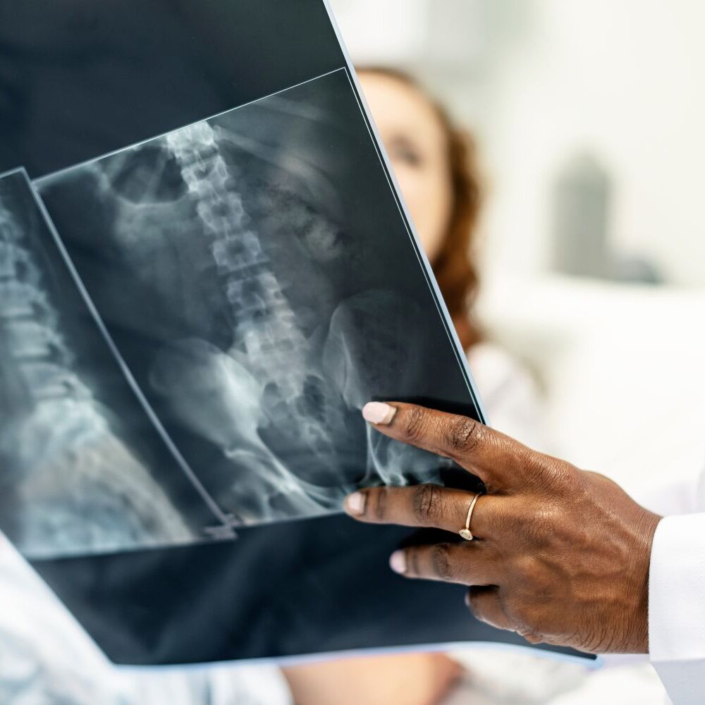 Understanding Two-Level ACDF Surgery